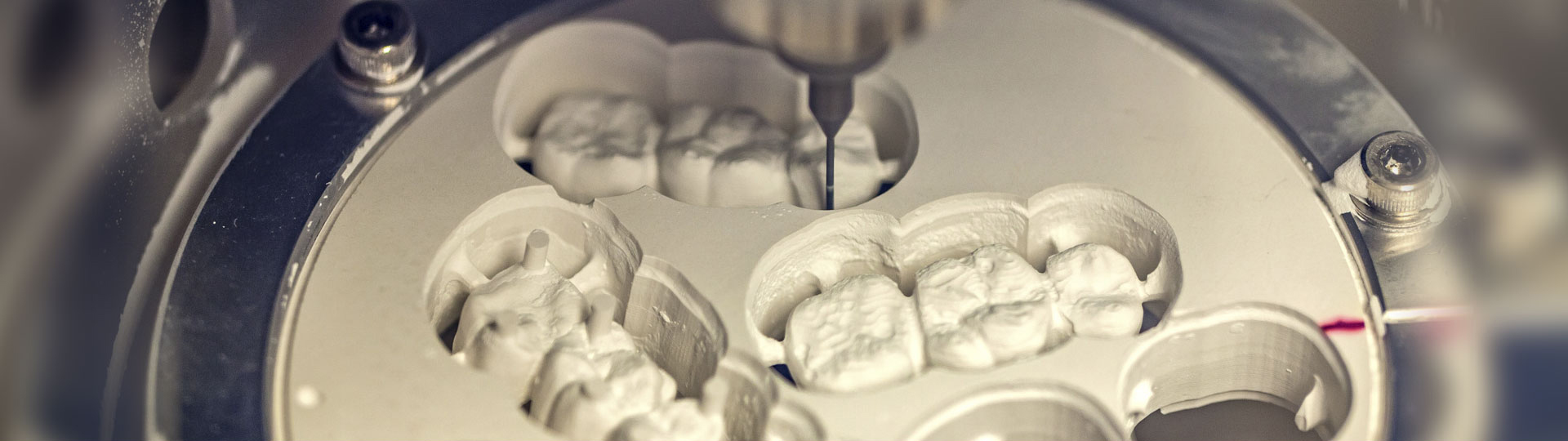 Die Modellgussprothese | Krämer Zahntechnik